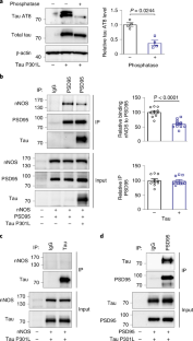 Tau induces PSD95–neuronal NOS uncoupling and neurovascular dysfunction ...