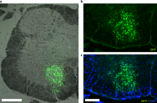 Targeted intraspinal injections to assess therapies in rodent models of ...