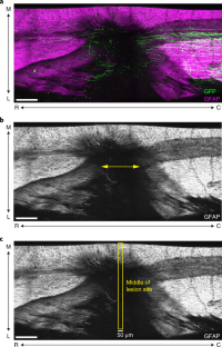High-resolution 3D imaging and analysis of axon regeneration in ...