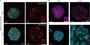 Antigen retrieval and clearing for whole-organ immunofluorescence by ...