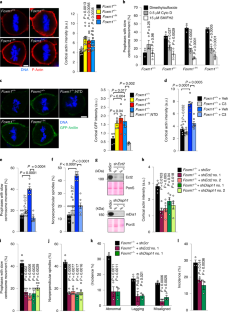 FoxM1 insufficiency hyperactivates Ect2–RhoA–mDia1 signaling to drive ...