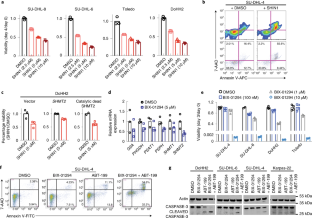 The serine hydroxymethyltransferase-2 (SHMT2) initiates lymphoma ...