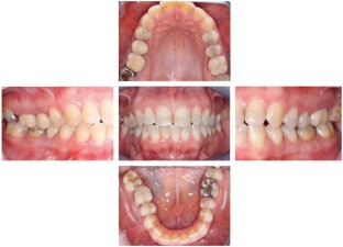Periodontal diagnosis in the context of the 2017 classification system ...