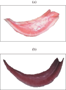 A Noninvasive Computerized Technique to Detect Anemia Using Images of ...