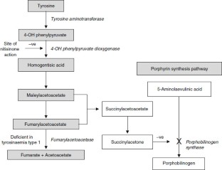 Nitisinone in the Treatment of Hereditary Tyrosinaemia Type 1 ...