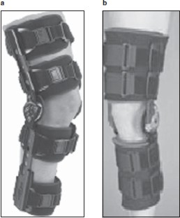 The Potential Role of Prophylactic/ Functional Knee Bracing in ...