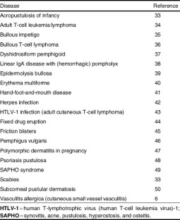 Pompholyx | SpringerLink
