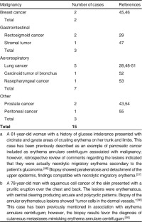 Paraneoplastic Erythema Annulare Centrifugum Eruption: PEACE | SpringerLink