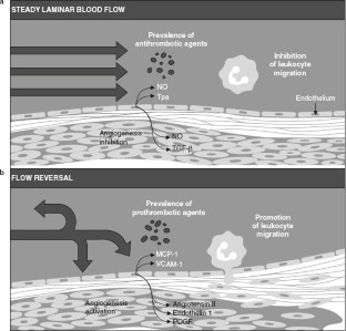 Sulodexide in the Treatment of Chronic Venous Disease | SpringerLink