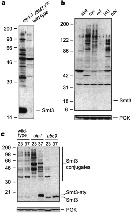 A new protease required for cell-cycle progression in yeast | Nature