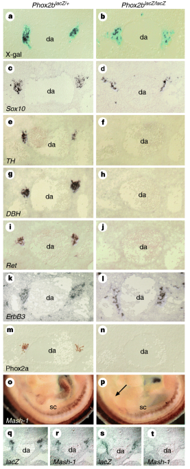 The homeobox gene Phox2b is essential for the development of autonomic ...