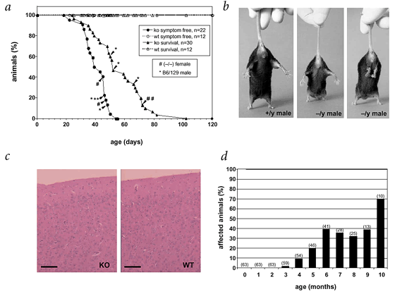 A mouse Mecp2 -null mutation causes neurological symptoms that mimic ...