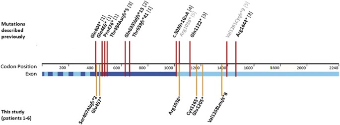 Bainbridge–Ropers syndrome caused by loss-of-function variants in ASXL3 ...