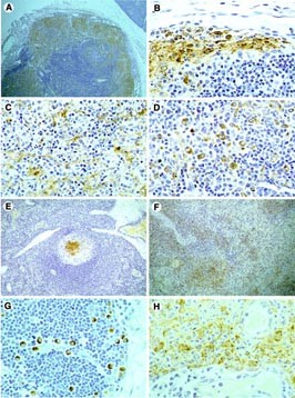 The Pathology of Experimental Aerosolized Monkeypox Virus Infection in ...