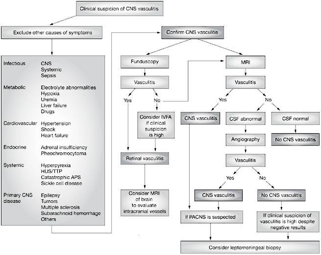 Diagnosis and treatment of vasculitis of the central nervous system in ...