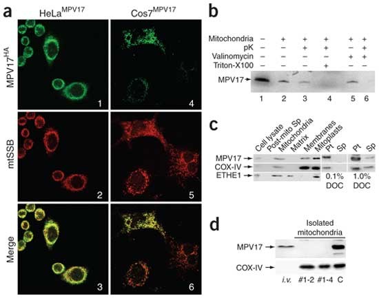 MPV17 encodes an inner mitochondrial membrane protein and is mutated in ...