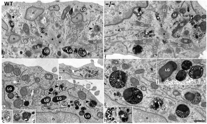 Adaptor protein 3–dependent microtubule-mediated movement of lytic ...