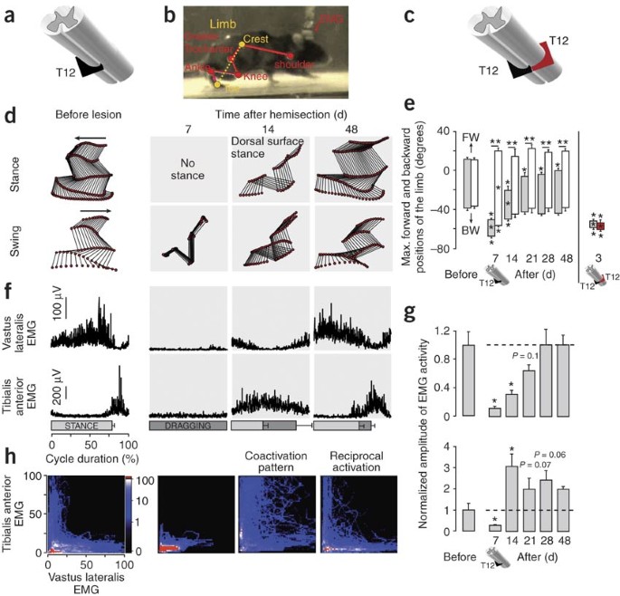 Recovery of supraspinal control of stepping via indirect propriospinal ...