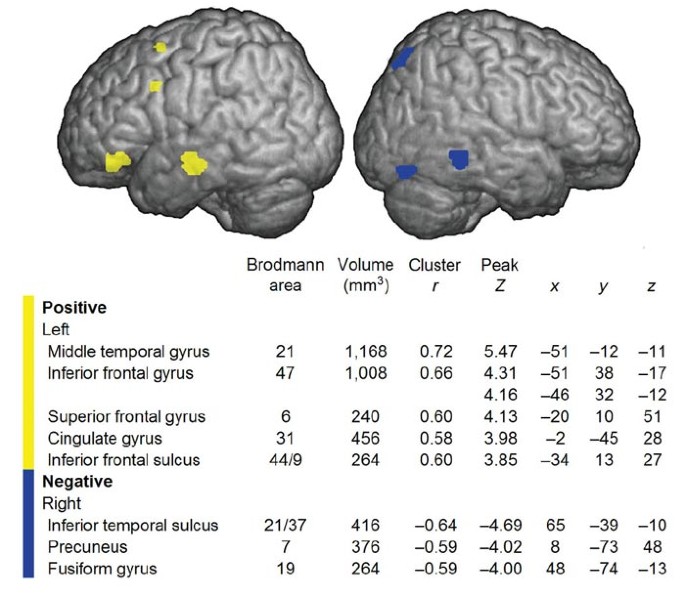 Development of neural mechanisms for reading | Nature Neuroscience