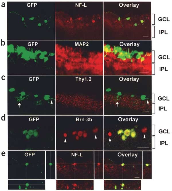 Robust neural integration from retinal transplants in mice deficient in ...