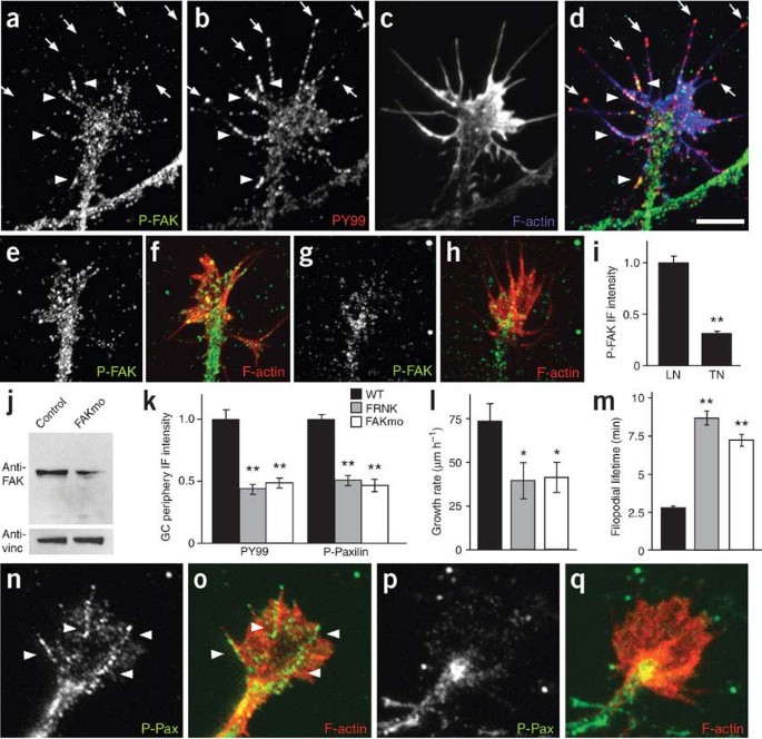 Focal adhesion kinase signaling at sites of integrin-mediated adhesion ...