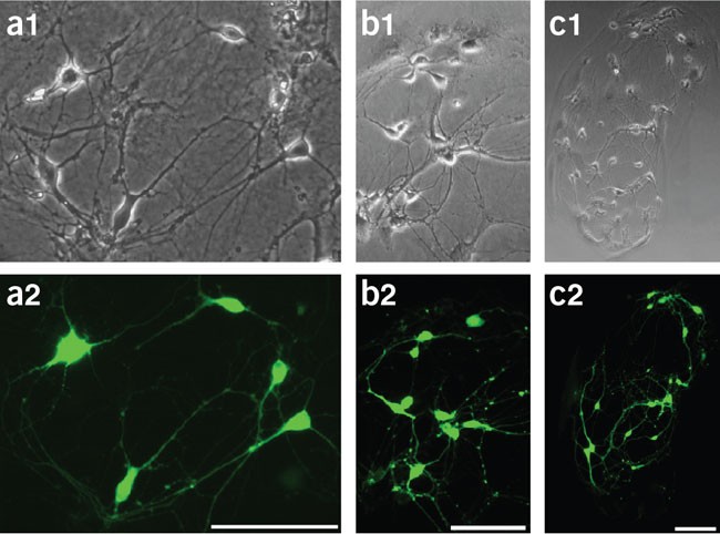 High Ca 2+ -phosphate transfection efficiency in low-density neuronal ...