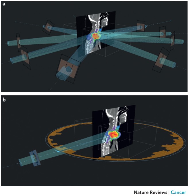 Radiation oncology in the era of precision medicine | Nature Reviews Cancer
