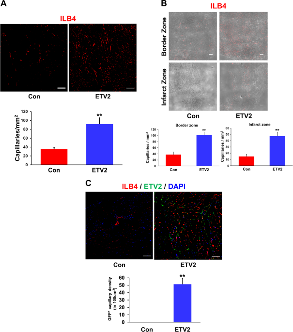 In vivo transduction of ETV2 improves cardiac function and induces ...