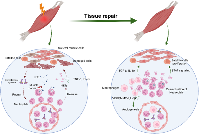 From inflammation to bone formation: the intricate role of neutrophils ...