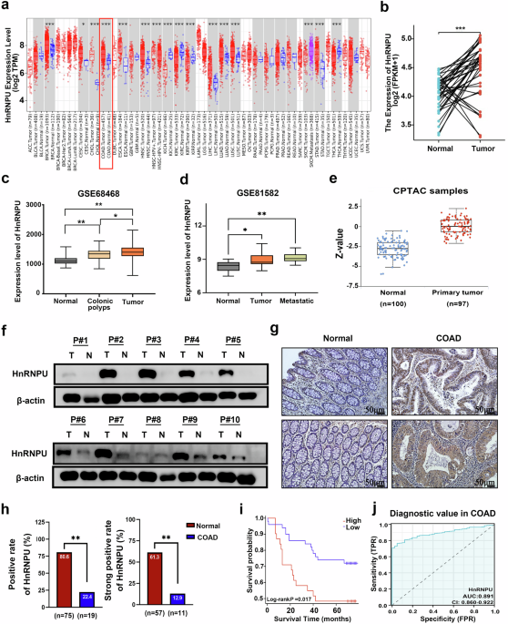 RNA-binding protein HnRNPU regulates proliferation and ferroptosis in ...