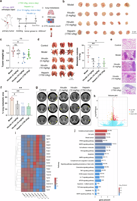 Hirudin suppresses hematogenous metastasis by targeting desmosome ...