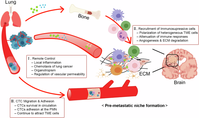 Brain metastasis from non-small cell lung cancer: crosstalk between ...