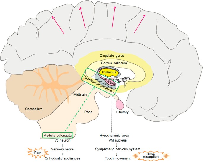 Orthodontic tooth separation activates the hypothalamic area in the ...