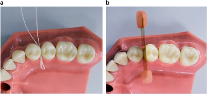 Orthodontic tooth separation activates the hypothalamic area in the ...