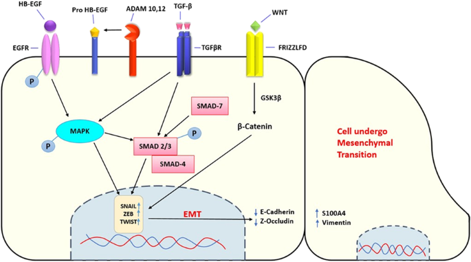 Heparin-binding epidermal growth factor (HB-EGF) drives EMT in patients ...