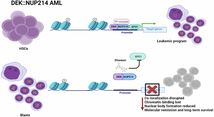 XPO1-dependency of DEK::NUP214 leukemia | Leukemia