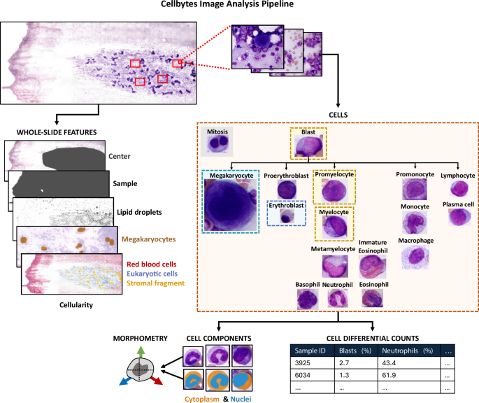 Granulocyte abundance and maturation state at diagnosis predicts ...