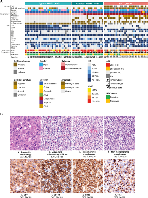 Divergent molecular pathways drive monomorphic epitheliotropic and ...