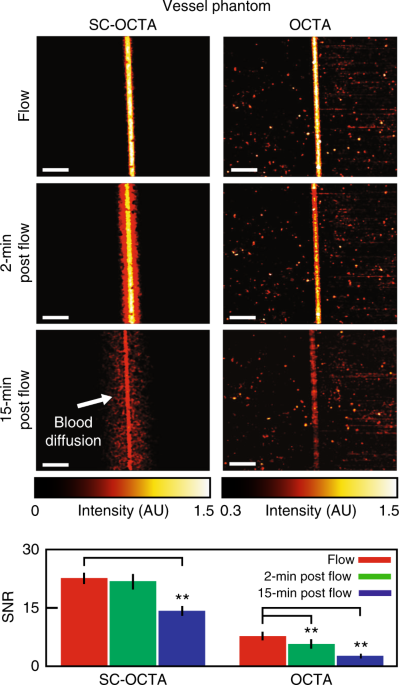 Spectral contrast optical coherence tomography angiography enables ...
