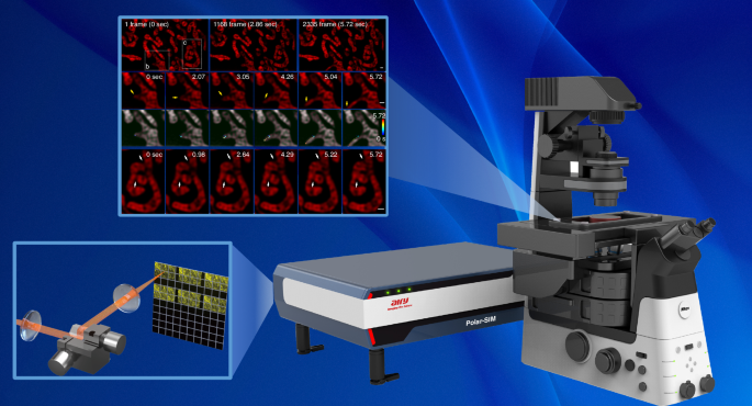 Fast, faster, and the fastest structured illumination microscopy ...
