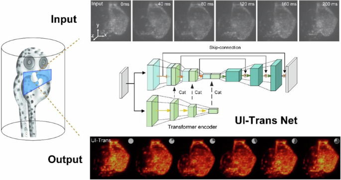 Deep learning enhanced light sheet fluorescence microscopy for in vivo ...