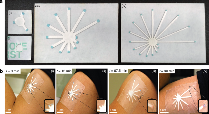 A mass-customizable dermal patch with discrete colorimetric indicators ...