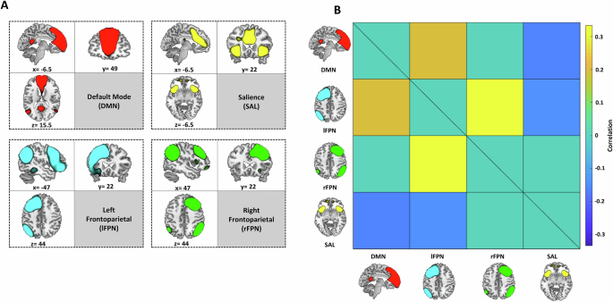Dysregulated connectivity configuration of triple-network model in ...