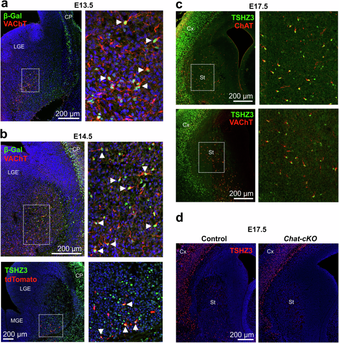 Altered striosome-matrix distribution and activity of striatal ...