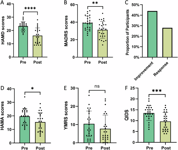 Transcranial temporal interference stimulation for treating bipolar ...