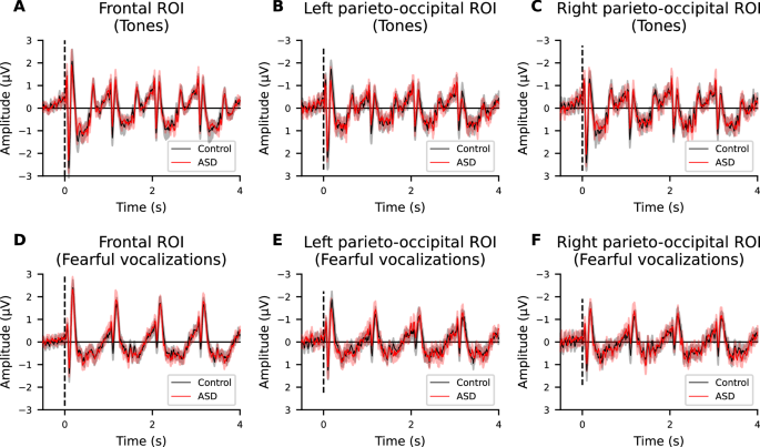 Comparative study of ERP habituation to tones and fearful vocalizations ...