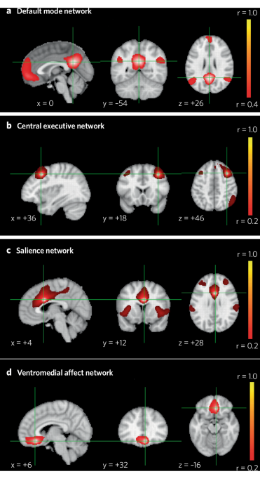 Breakthroughs and challenges for generating brain network-based biomarkers of treatment response ...