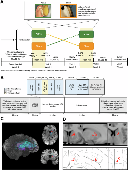Reversible modulation of a deep white matter surgical target for ...