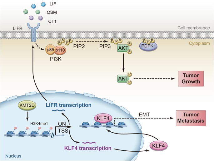 Histone methyltransferase KMT2D sustains prostate carcinogenesis and ...