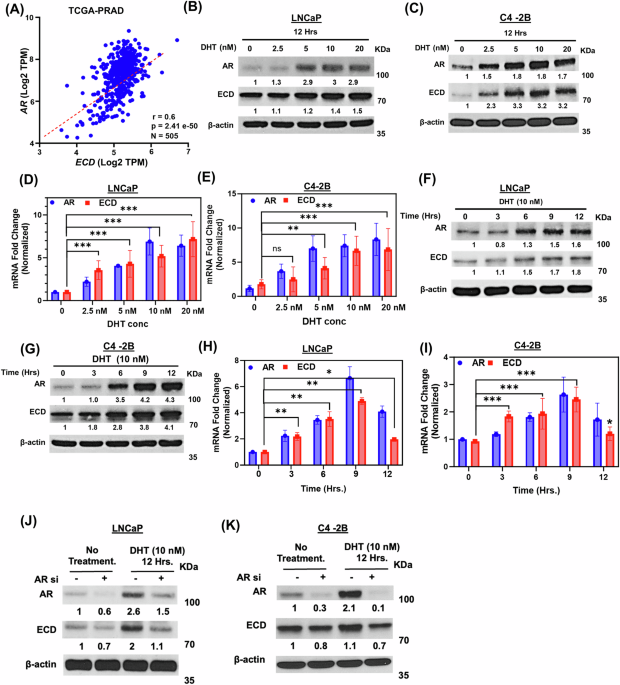 ECD, a novel androgen receptor target promotes prostate cancer ...